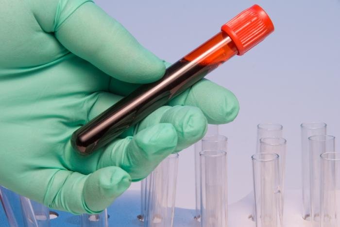 Sickle Cell Disease (SCD) | MetroHealth HMO